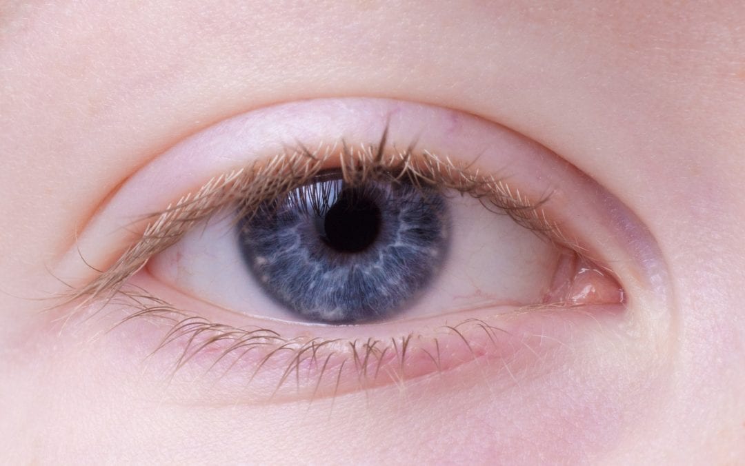 Blepharitis | Eye Clinic Opticians
